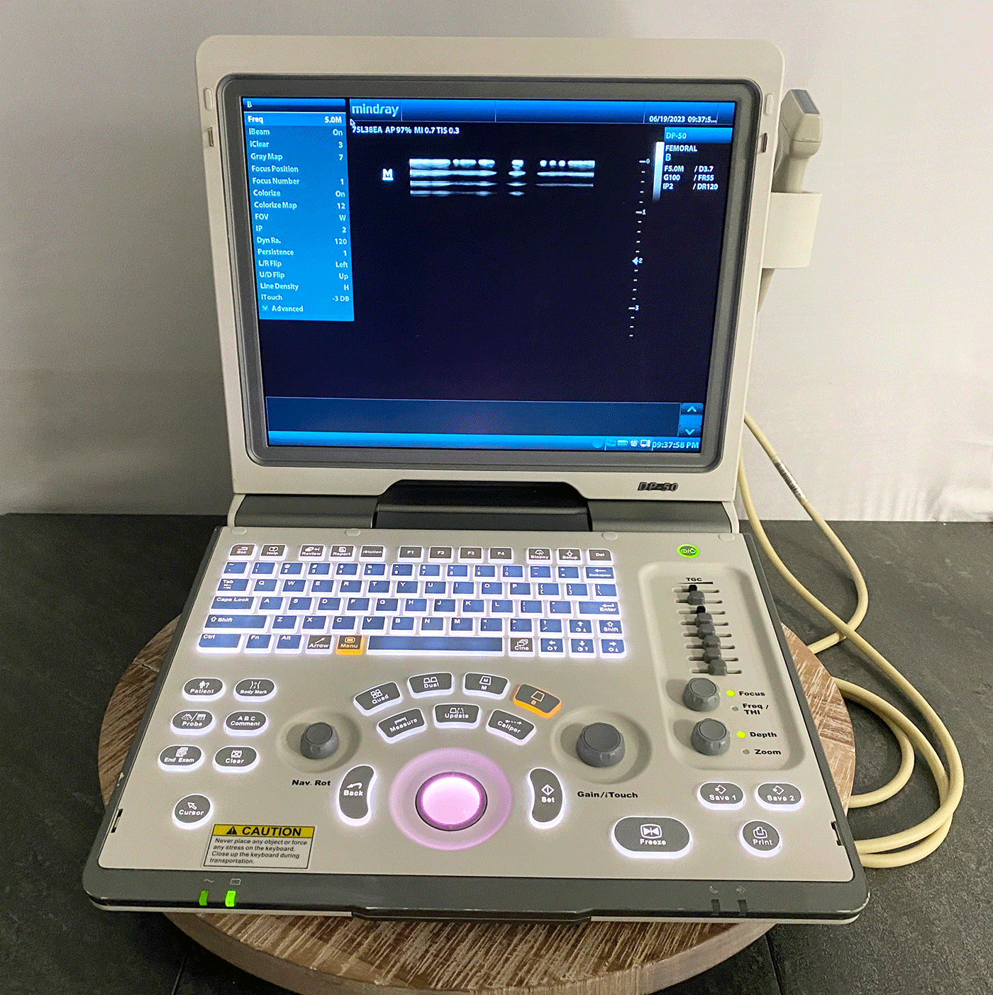 Mindray Dp 50 Digital Portable Ultrasound System With 75l38ea Linear T